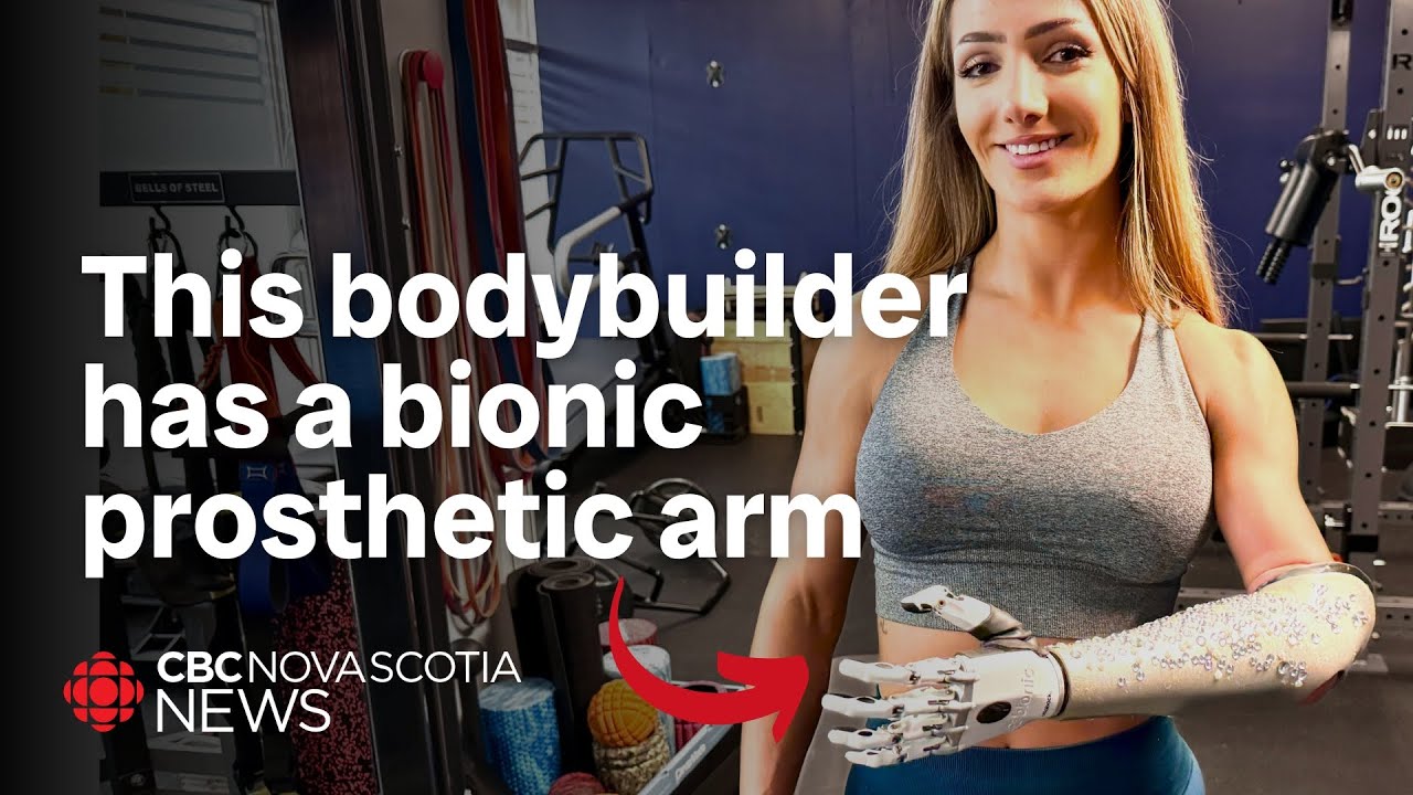 Meet the bodybuilder with a bionic prosthetic arm - YouTube