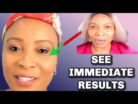 APPLY THIS EVERY NIGHT AND LOOK 18 YEARS YOUNGER! DIY SKIN TIGHTENING ANTI-AGING FACE CREAM