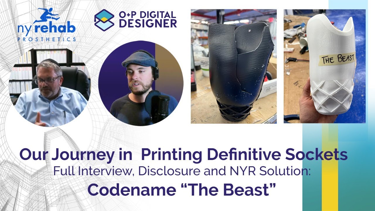 the Journey in 3D Printing Definitive Sockets - Interview with Mike ...