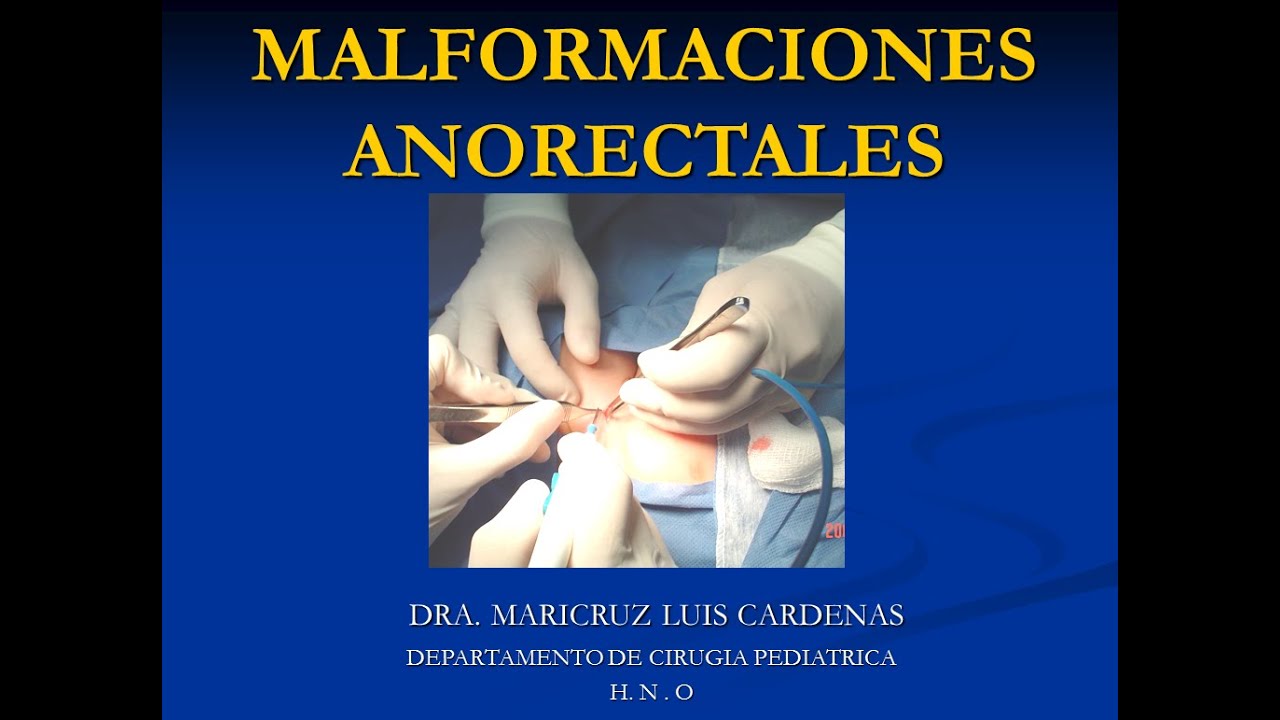 MALFORMACIONES ANORECTALES - YouTube