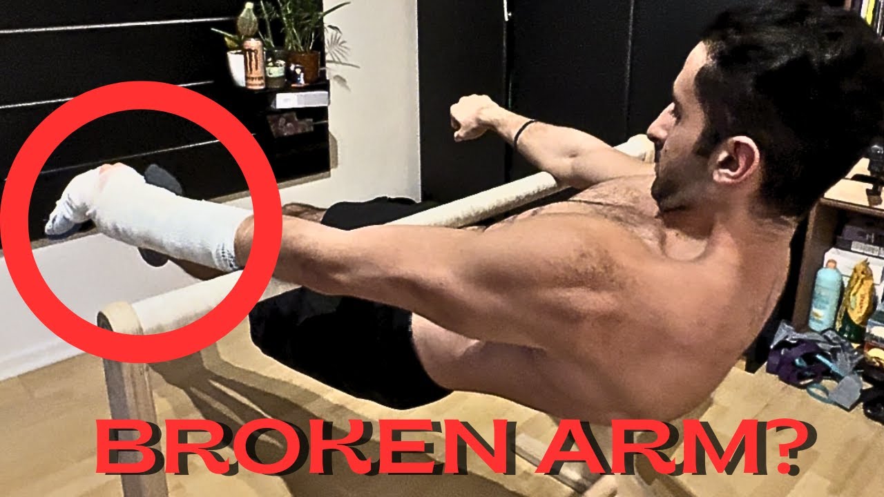 Bro came to the calisthenics session with a broken arm 💀 [RAW Episode 2 ...