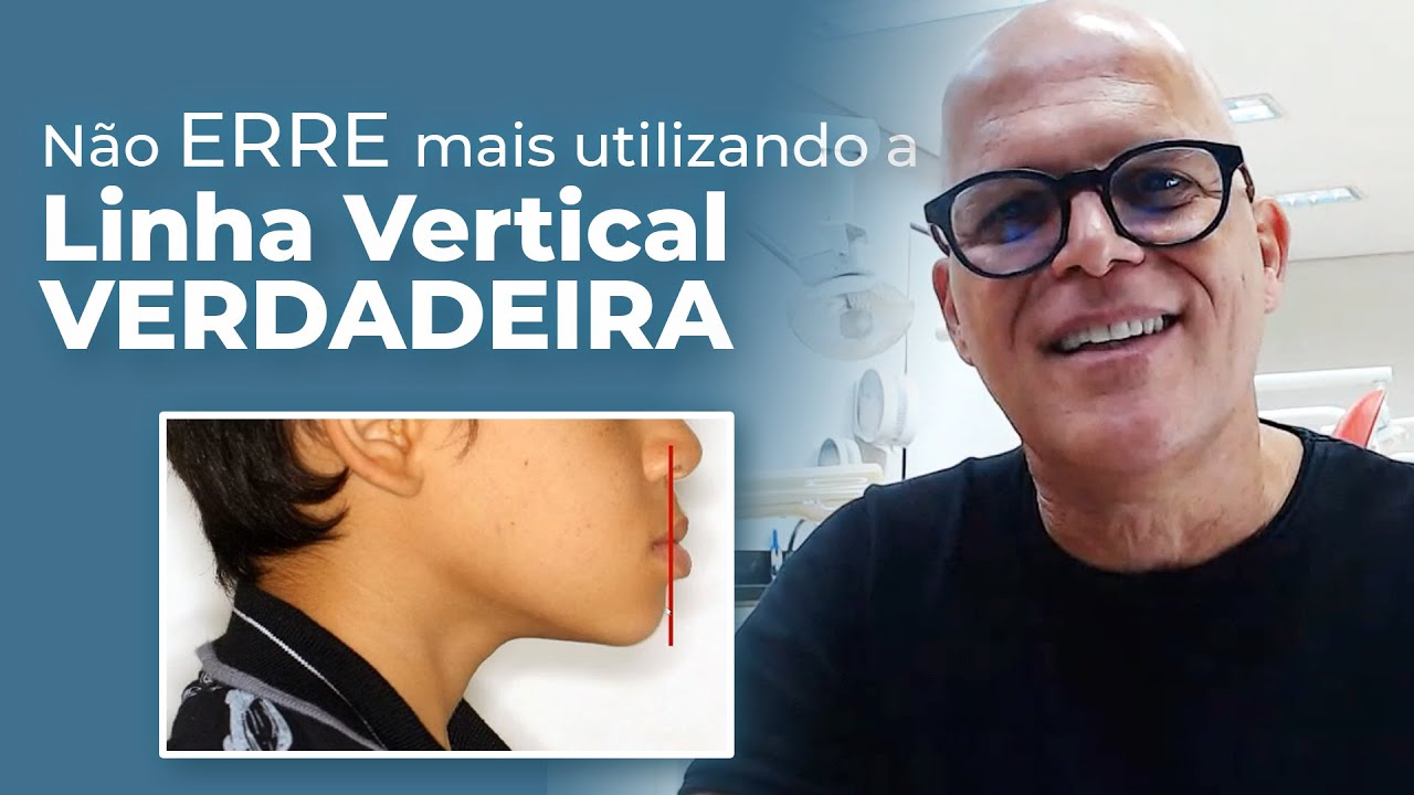 Linha vertical verdadeira entenda de uma vez por todas no Tratamento ...