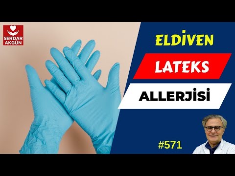 571. Alerji, Eldiven Alerjisi, Lateks Alerjisi ,Prof.Dr.Serdar Akgün,Sağlıklı Yaşam,Sağlık Haberleri