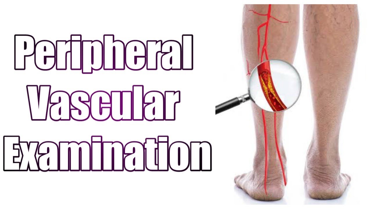 Peripheral Vascular Examination - OSCE Guide ll Blood supply of body ll ...