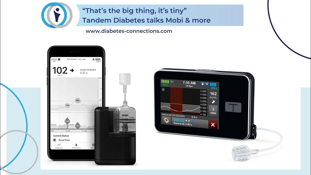 “That’s the big thing: it’s tiny” - Talking with Tandem Diabetes about ...