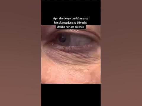 Aşırı stres ve yorgunluğa maruz kalmak. - YouTube
