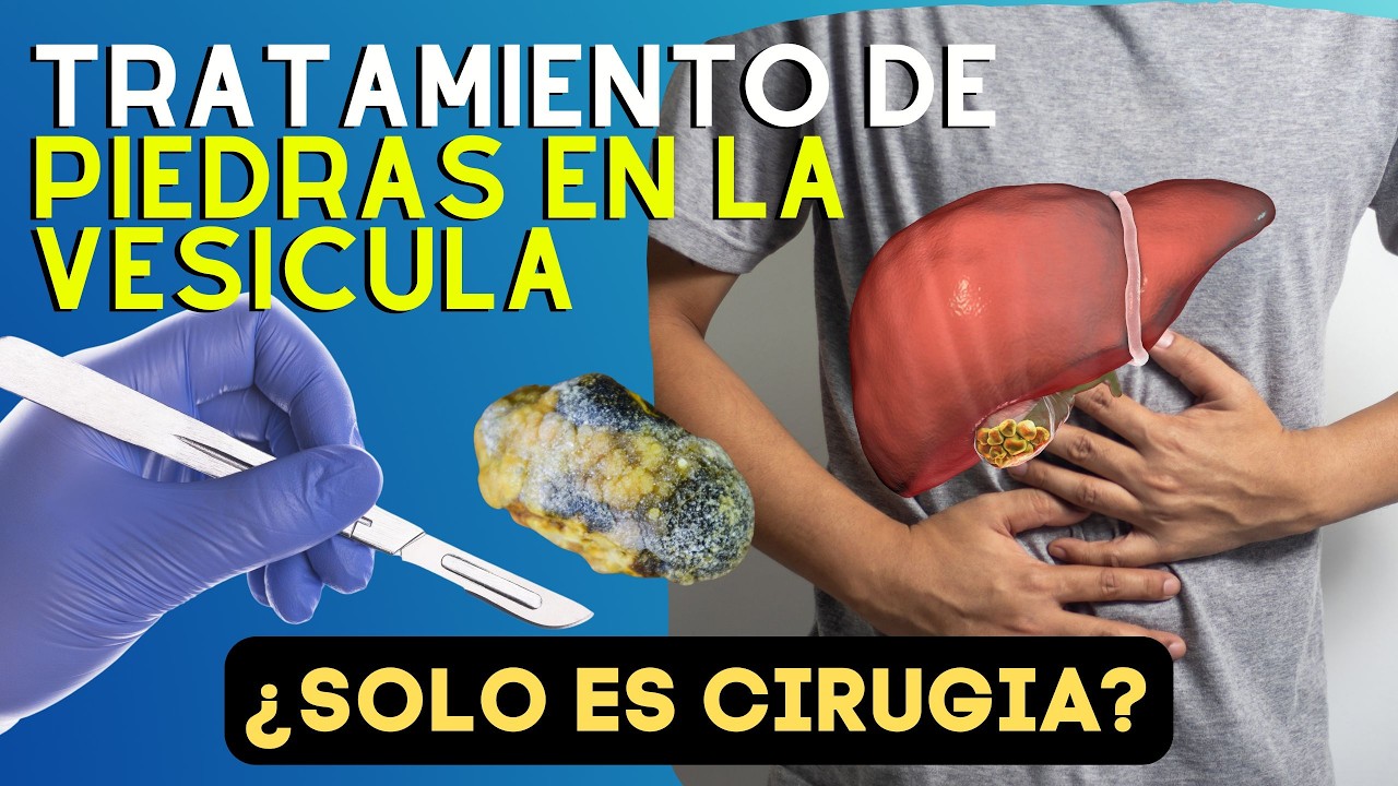 Como Tratar Las Piedras en La Vesícula | Dr Alan Collazo - YouTube Music