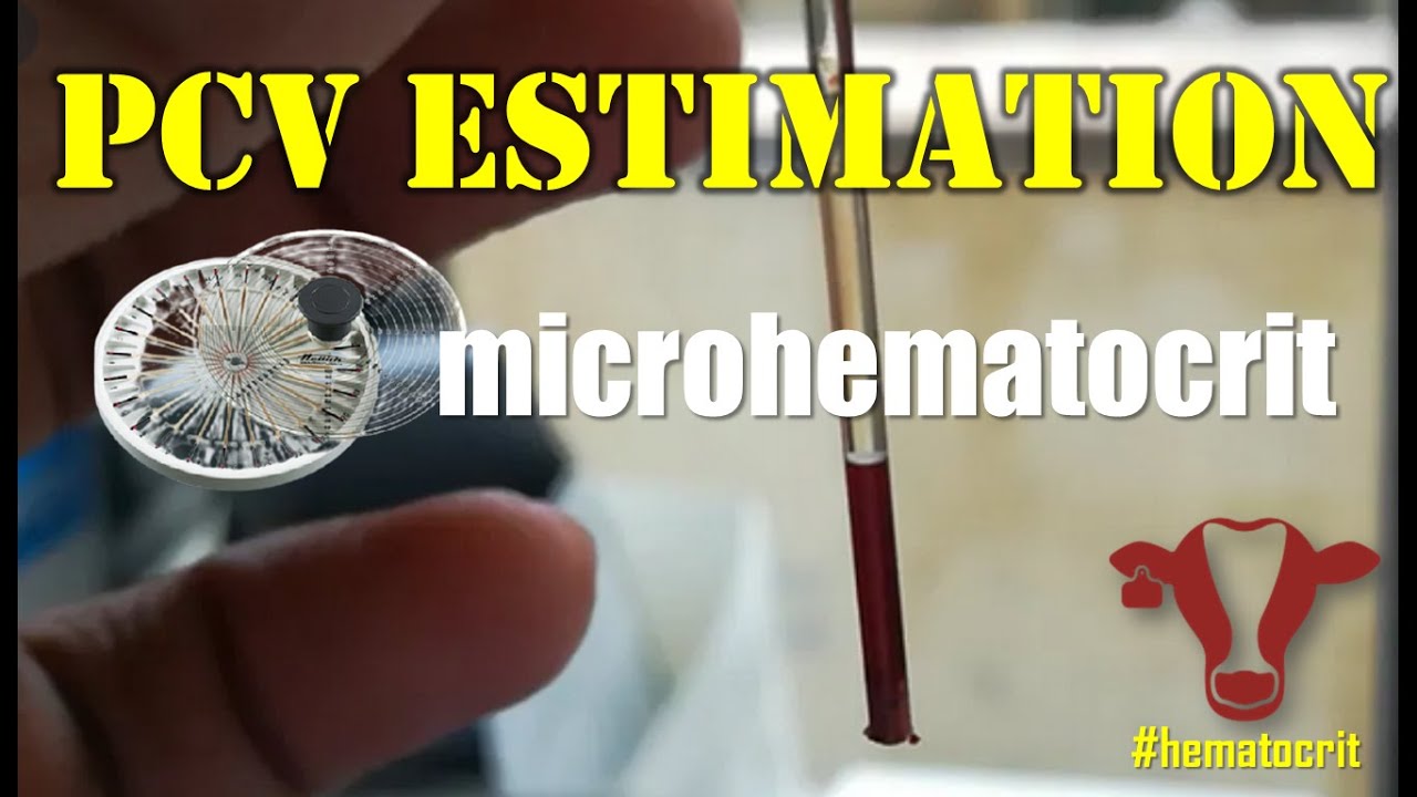 Micro hematocrit PCV | Packed Cell Volume | #hematocrit # ...