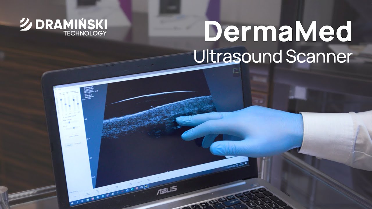 DermaMed Ultrasound Scanner Draminski – skin diagnostics in practice ...