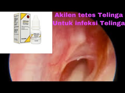 Obat antibiotik Tetes Telinga Akilen untuk mengatasi infeksi Telinga ...