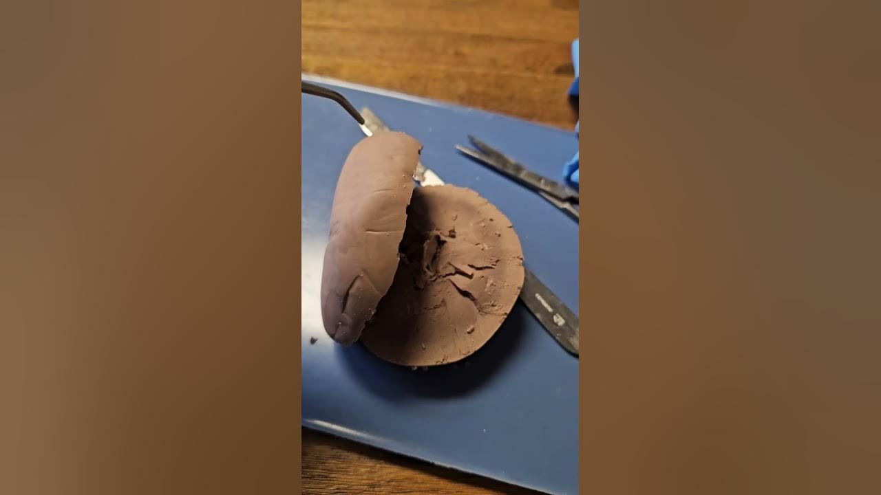 Bio 221 lab sheep kidney dissection - YouTube