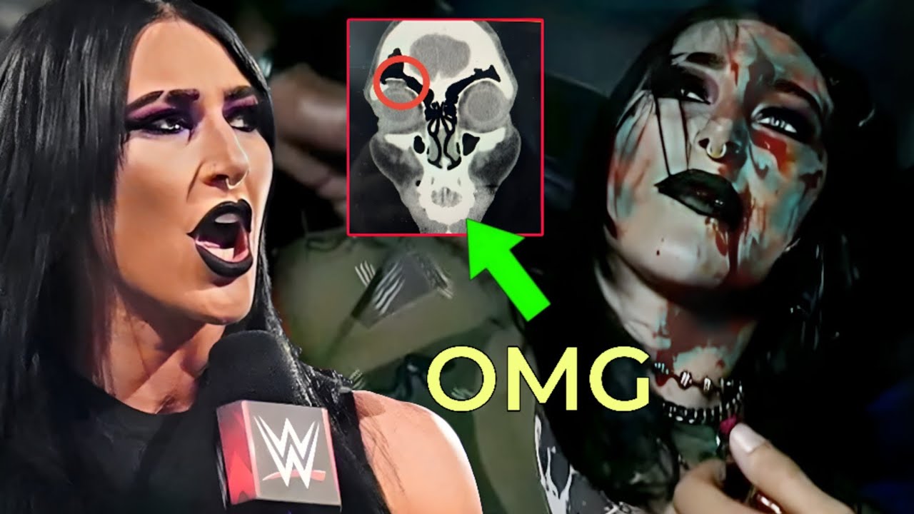 Breaking News! rhea ripley is hospitalized! it will shock you - YouTube