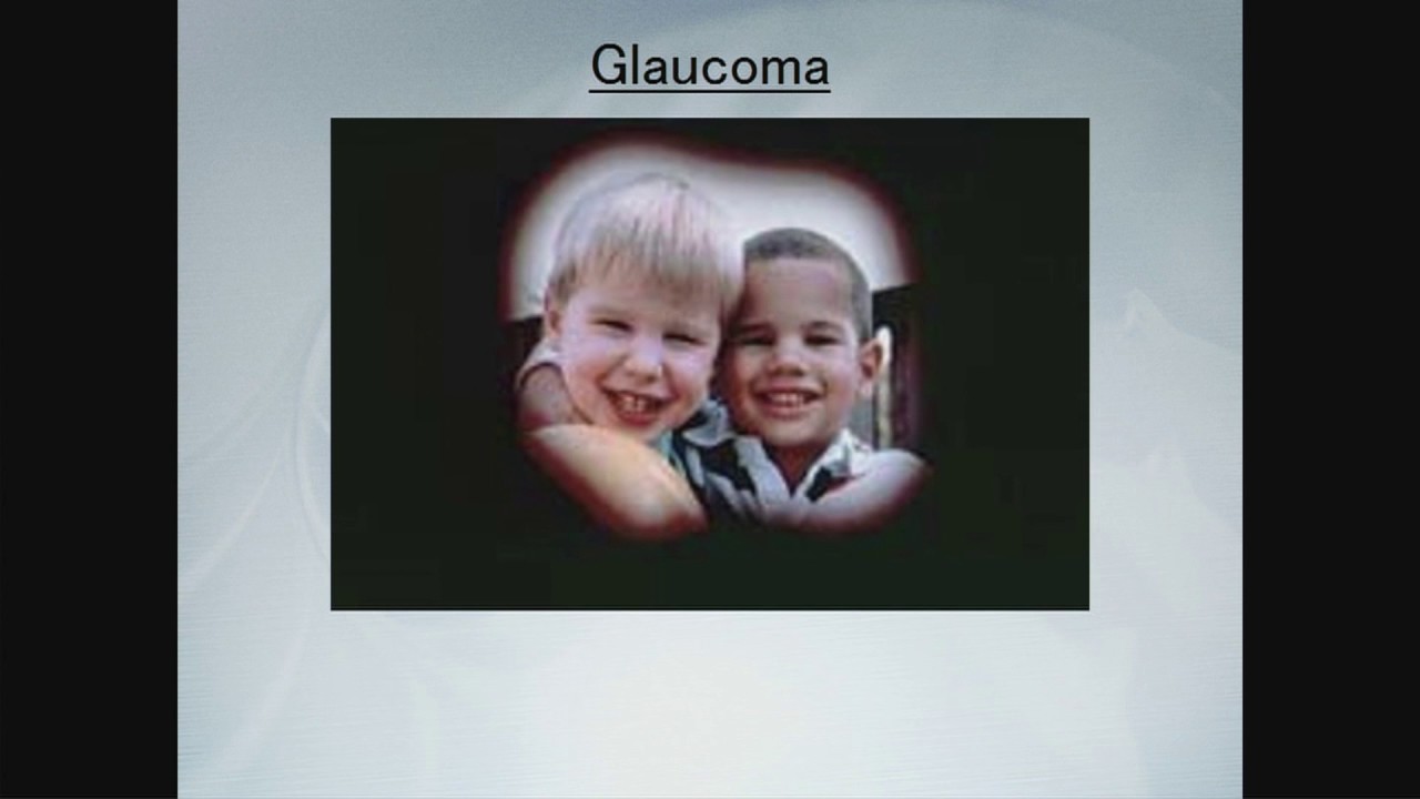 2016 Saving Sight Symposium :: Steve Sauer, MD :: The Aging Eye - YouTube