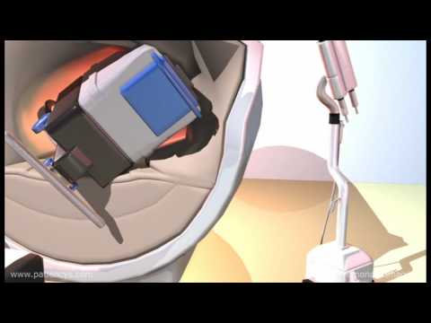 MRI Safety: Simulated Accident - Patiencys - YouTube