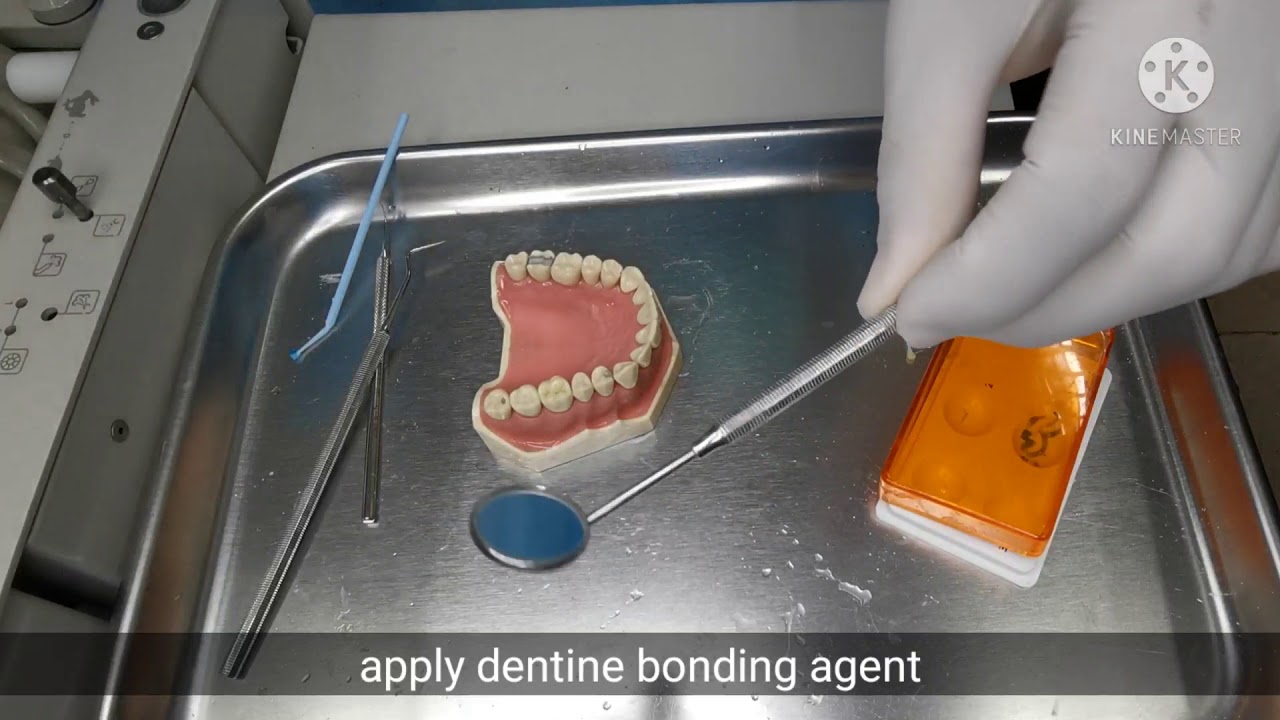 Class I Composite Restoration on Upper First Molar Tooth-Video Demo For ...