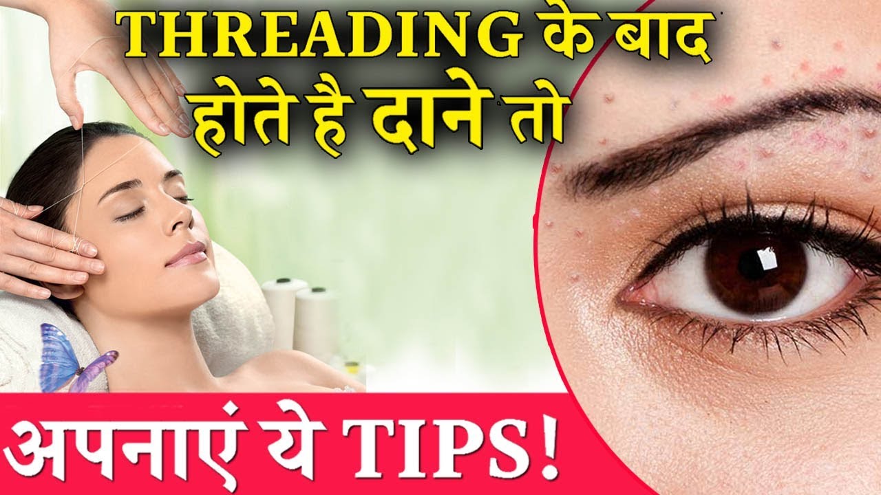 Bumps After Threading? 7 Proven Ways to Get Rid of Them, Fast ...