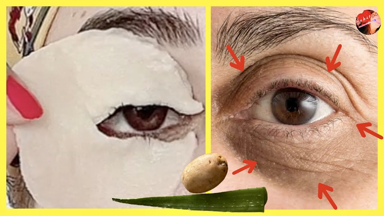 For 3 Days, She Put These Potato-Eye-Pads ,Said Good-Bye to Wrinkles ...