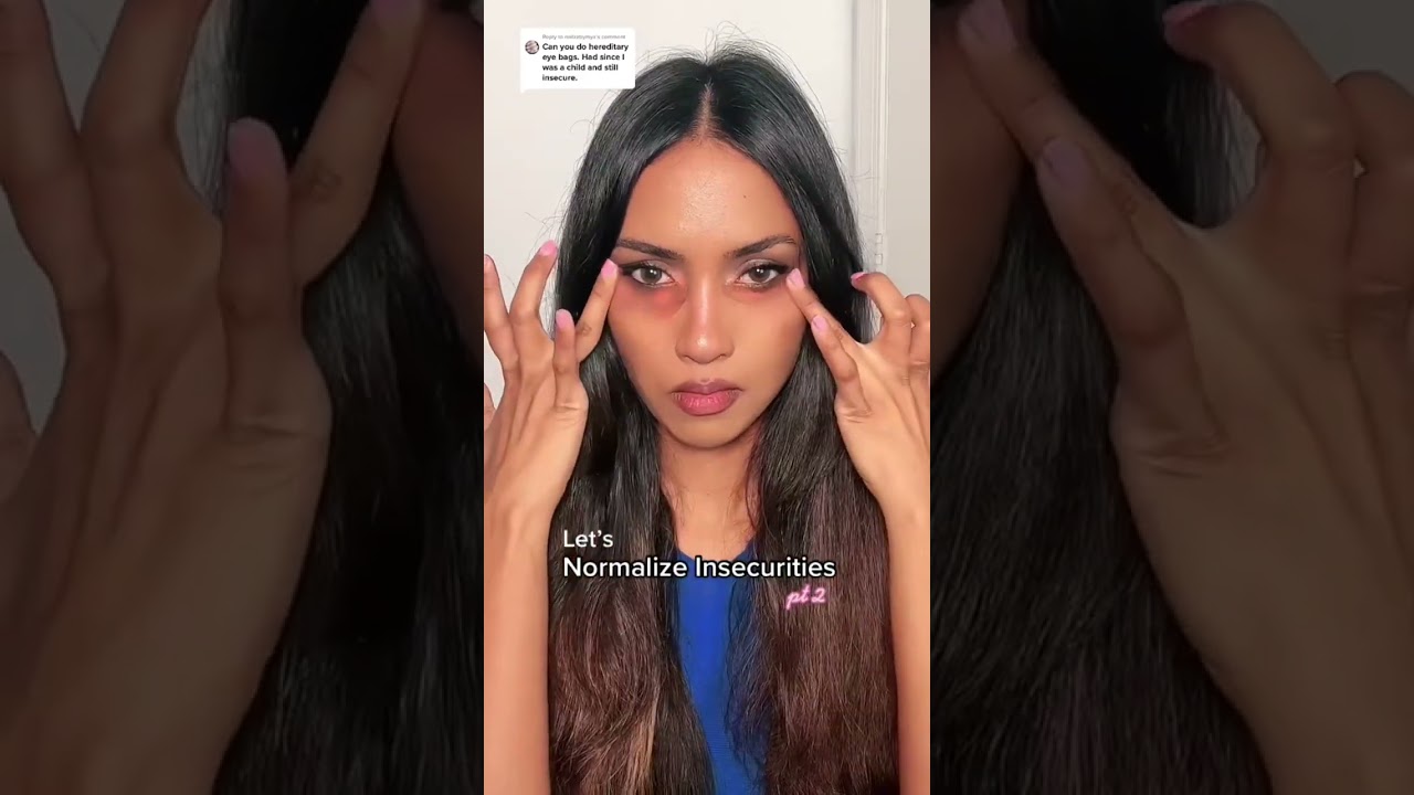 NORMALIZING INSECURITY- EYE BAGS 👜👛 - YouTube