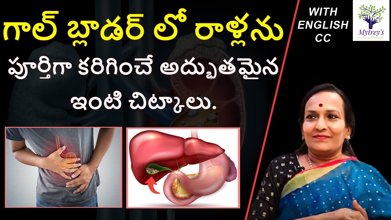 How to Remove Gallbladder Stone Naturally | పిత్తాశయంలో రాళ్ళు తొలగించే ...