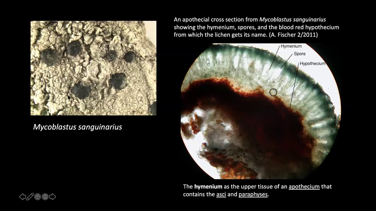 Crustose Lichen Cross Section