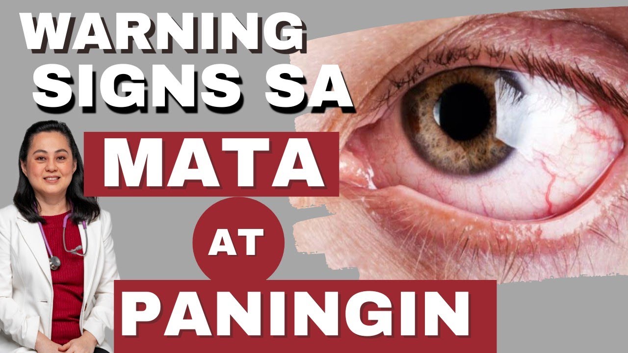 Warning Signs na May Problema sa Mata at Paningin - YouTube