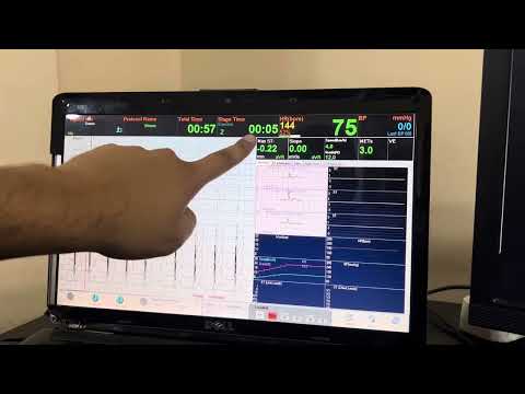 Dms Stress Test Training - YouTube