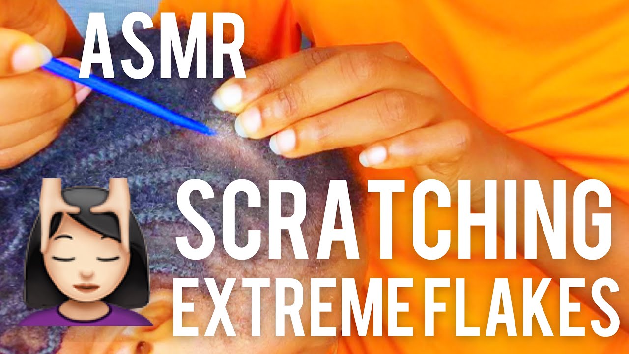 SCALP SCRATCH AND DANDRUFF CHECK ON 4C HAIR | REMOVING FLAKES - YouTube