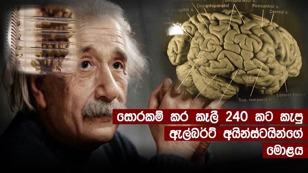 Albert Einsteins Brain In Jar