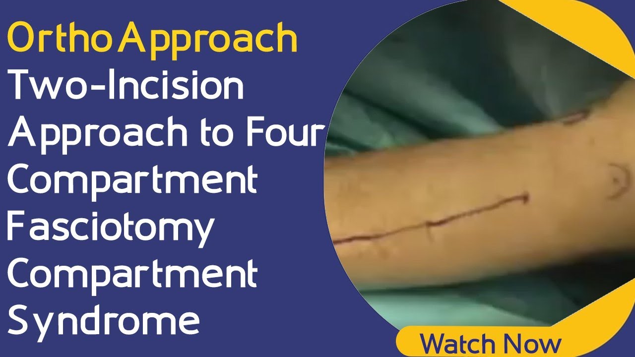 OrthoApproach - Two-Incision Approach to Four Compartment Fasciotomy ...