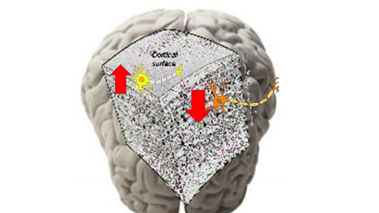 upper-cortical-brain-cellular-impairment-in-schizophrenia-patients