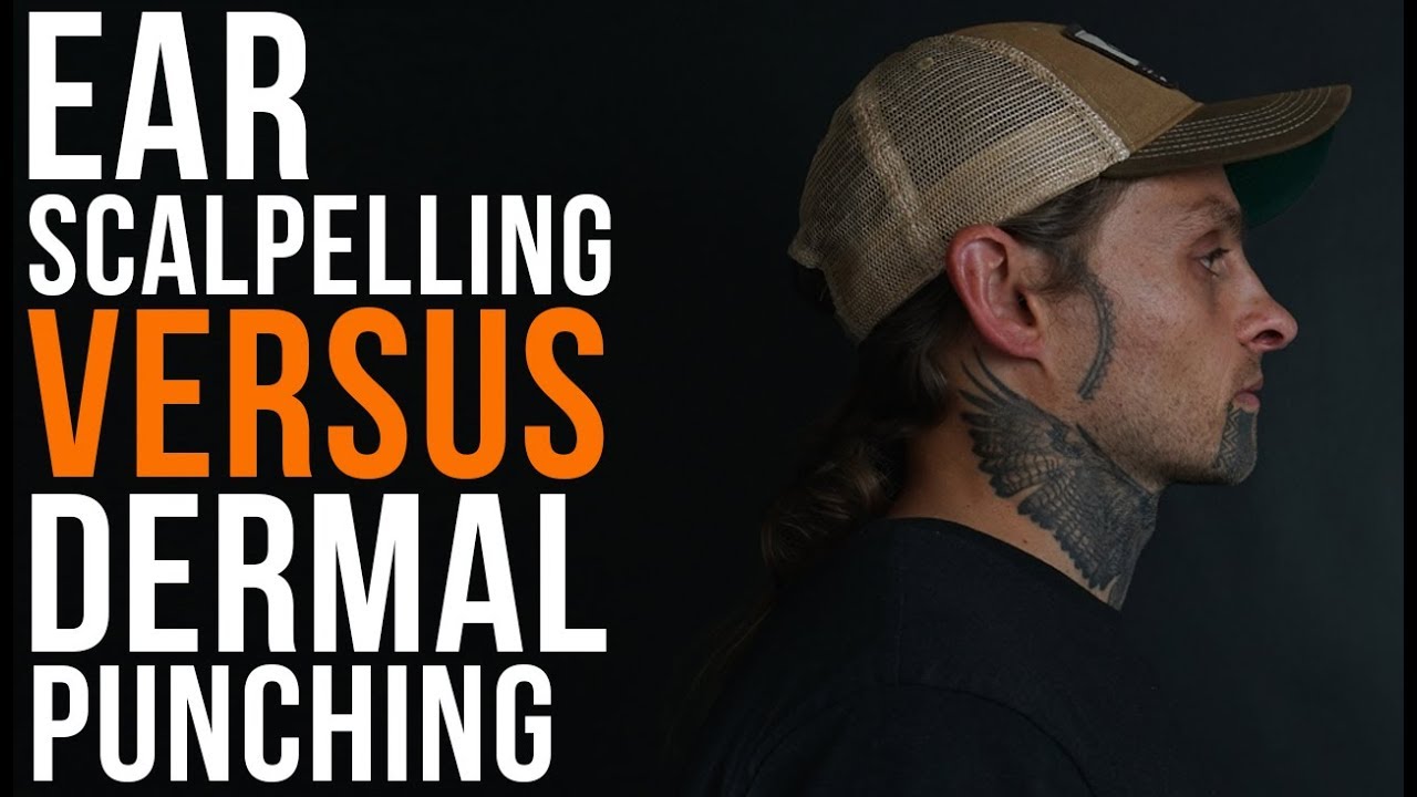 Ear Scalpelling VS Dermal Punching | UrbanBodyJewelry.com - YouTube