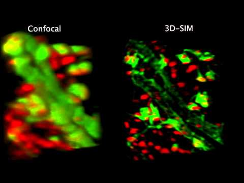 Confocal vs 3D structured illumination - YouTube