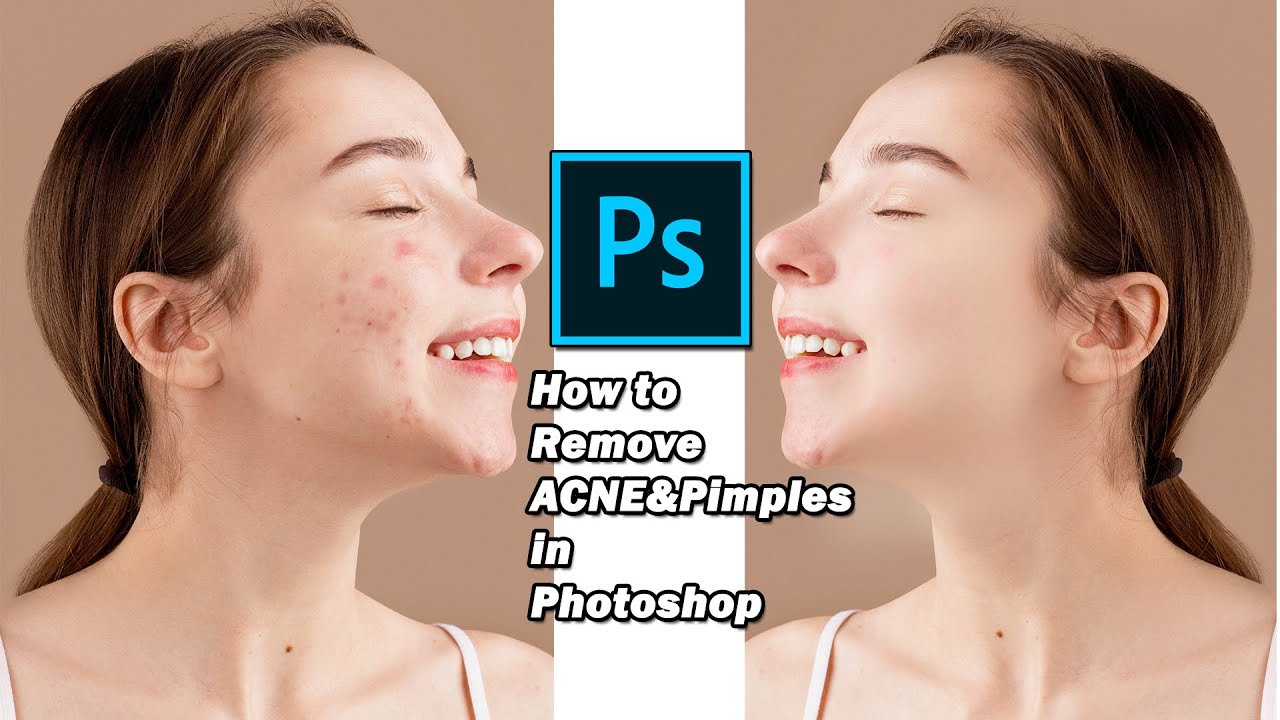 How to remove pimples from face in Adobe Photoshop CS5 - YouTube
