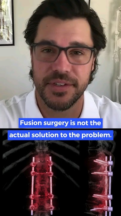 Will Spinal Fusion Surgery solve your problem? - YouTube