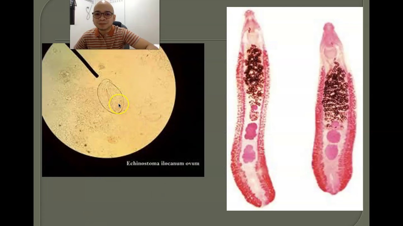 Trematodes Part 2 - YouTube