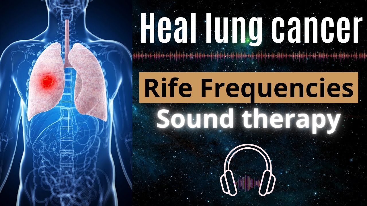 Resonant Frequencies Rife Therapy for Lung Cancer Treatment - YouTube