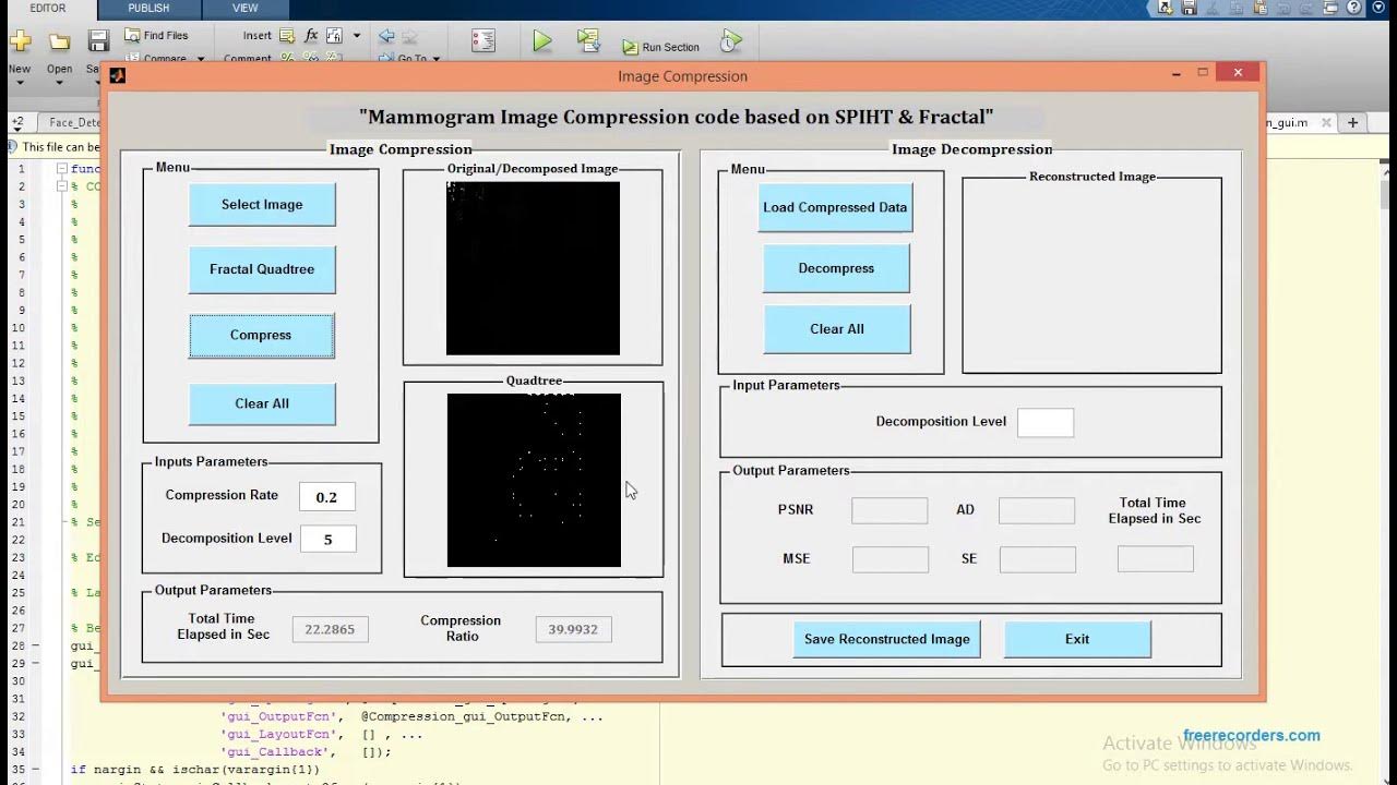 Mammogram Image Compression using SPIHT & Fractal MATLAB source code - YouTube