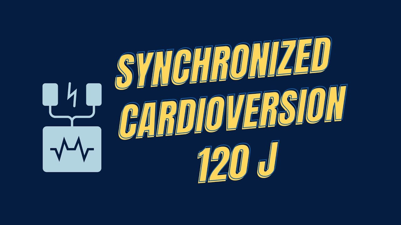 3C - Synchronized cardioversion 120 J - YouTube