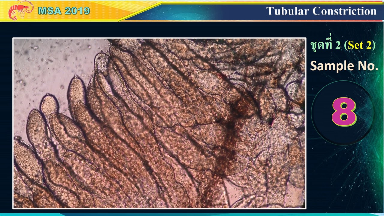 Constriction 02 08 - YouTube