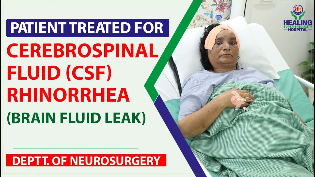 Patient Treated for CSF Rhinorrhea (Brain Fluid Leak) | Dept. of ...