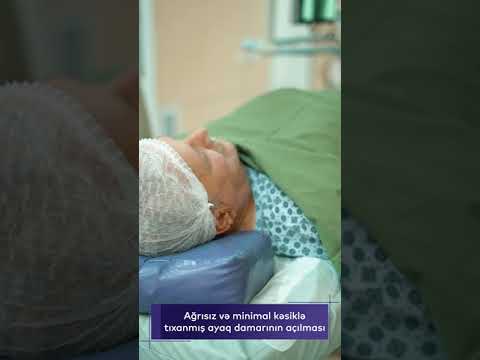Ağrısız və minimal kəsiklə tıxanmış ayaq damarının açılması