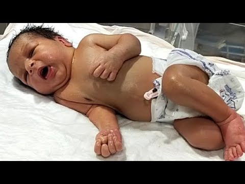 “NNJ Baby Recovered in 2 Days 💛 | Going Home Healthy & Strong 🏠” ️ ...