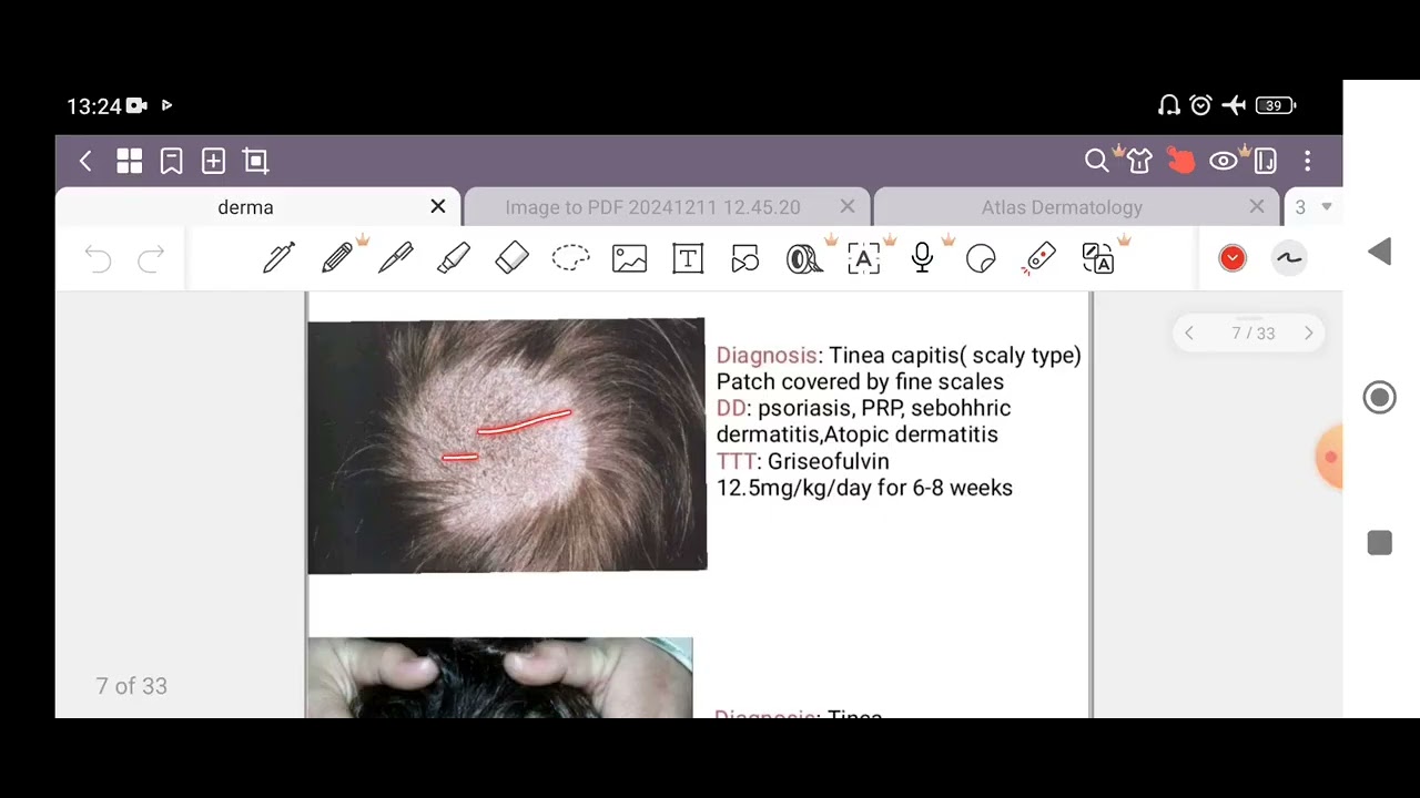 Derma pract(Derm,trauma 42) - YouTube