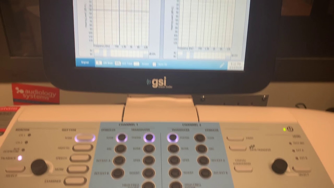 Audiostar Pro General button set up - YouTube