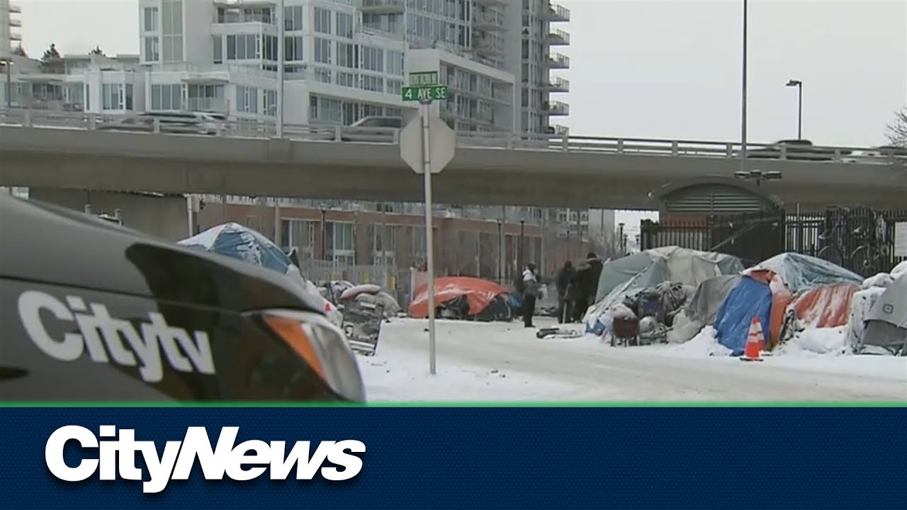 Amputations due to frostbite reach 10-year high in Calgary - YouTube