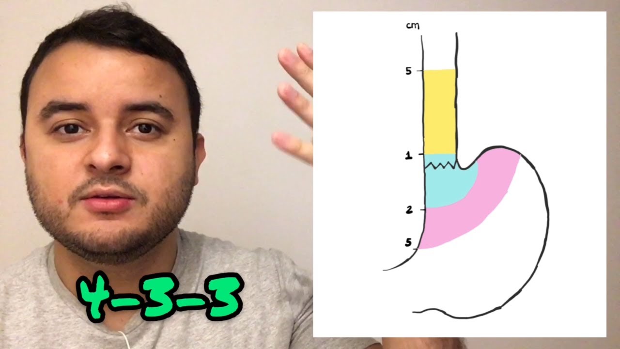 Classificação de SIEWERT - YouTube