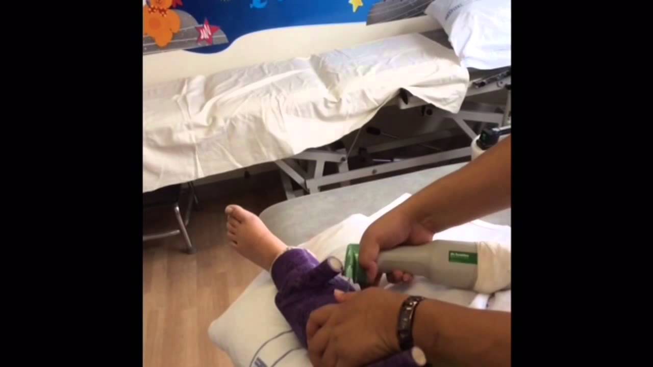 Getting my cast off - YouTube