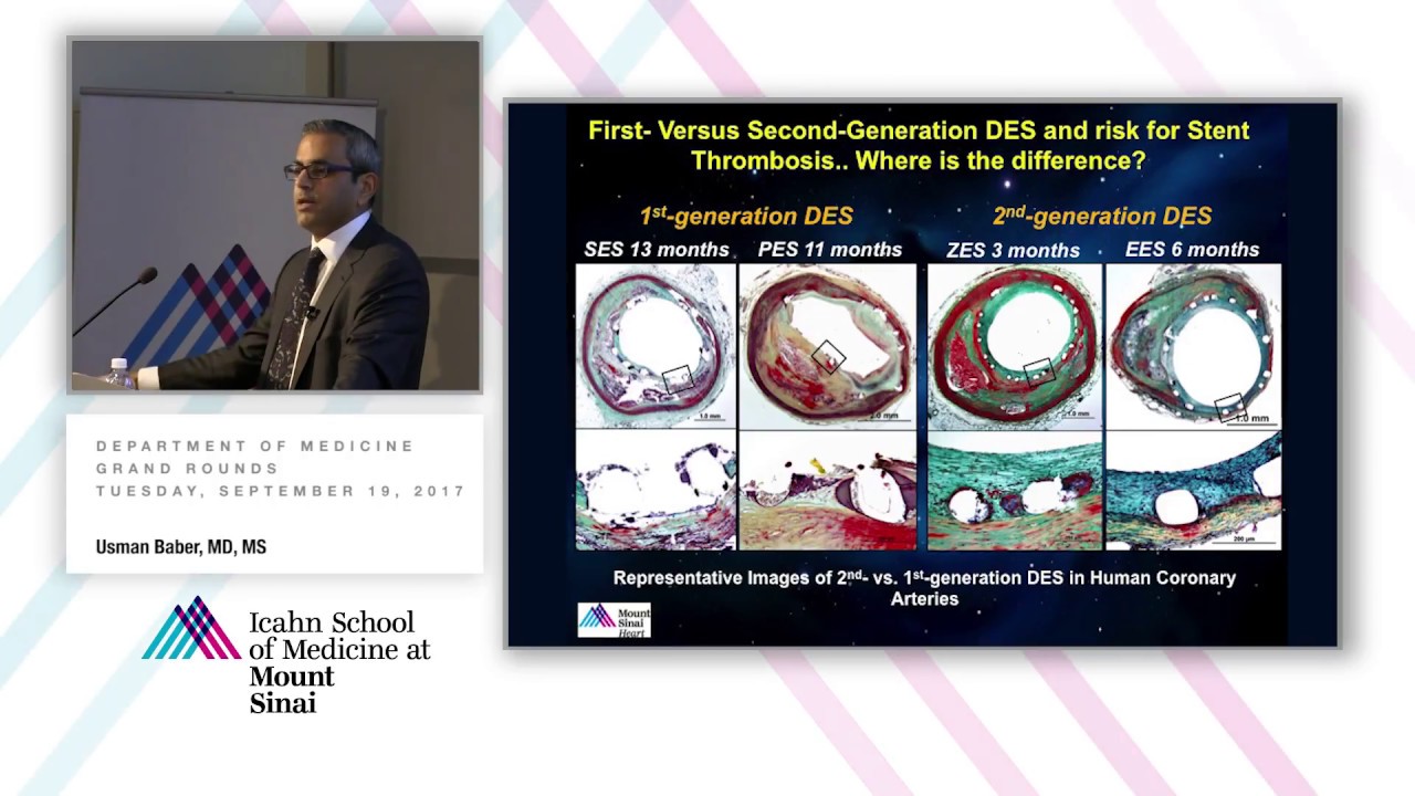 Evolution of Dual Antiplatelet Therapy After Coronary Stent ...