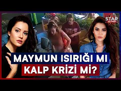 Maymun Isırığı İddia Edilmişti, Ünlü Oyuncunun Ölümüne İlişkin Ön Rapor Tamamlandı | Star Ana Haber