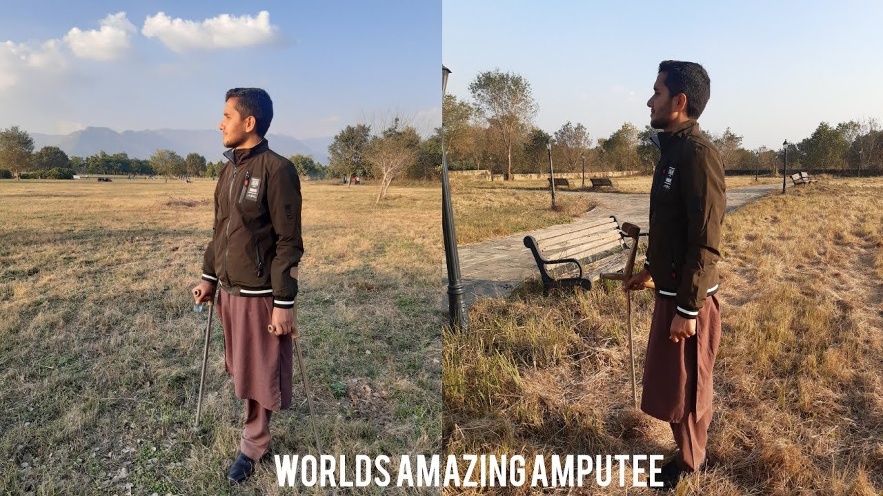 World's amazing Amputee #Evening Walk#One Legged Life - YouTube